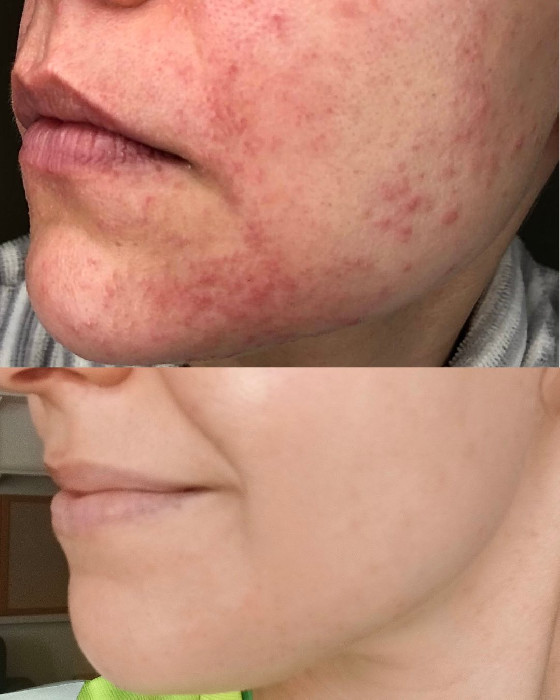 Ruusufinni :: Kosmetologijenny